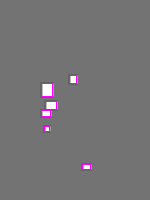 Acne Object Detection Dataset (v21, 2022-01-31 9:32pm) by Kritsakorn