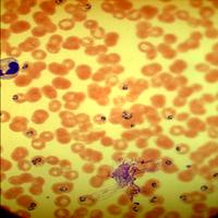 MALARIA PARASITE DATASET Object Detection Model (v1, 2025-07-20 9:51pm) by TechVerge Africa